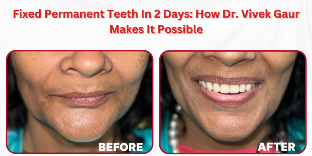 Fixed Permanent Teeth In 2 Days: How Dr. Vivek Gaur Makes It Possible