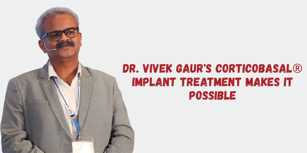 Understanding Basal Implants: Types And Benefits